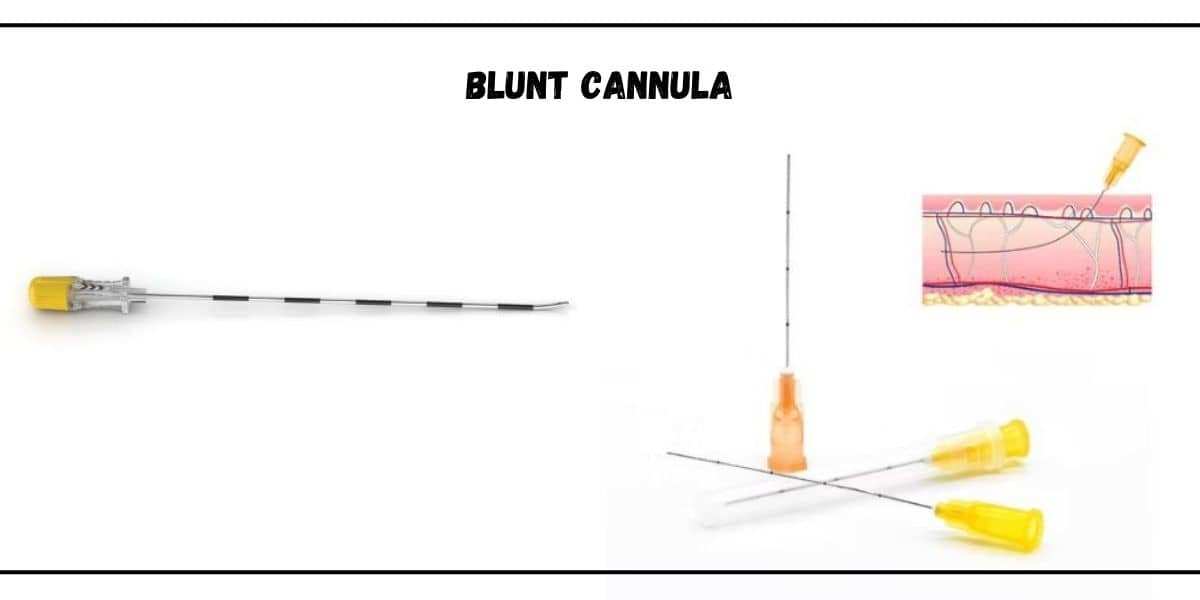 The Different Types of Cannulas and Their Life-Saving Uses