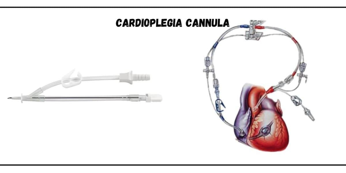 The Different Types of Cannulas and Their Life-Saving Uses