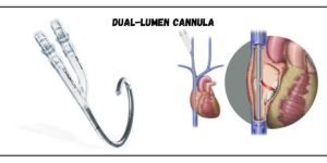The Different Types of Cannulas and Their Life-Saving Uses